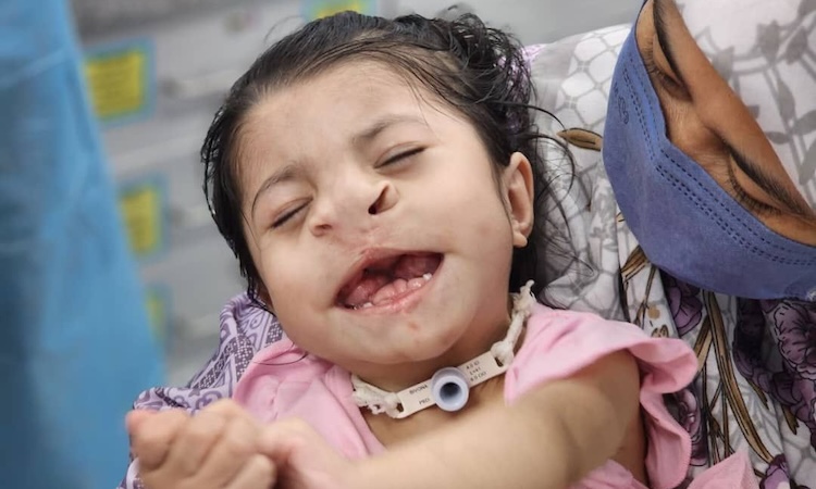 Bakal Jalani 4 Lagi Pembedahan Mulut, Adik Nur Iman Perlu RM400,000